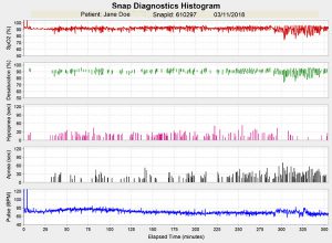Sleep Histogram – Snap Diagnostics, LLC